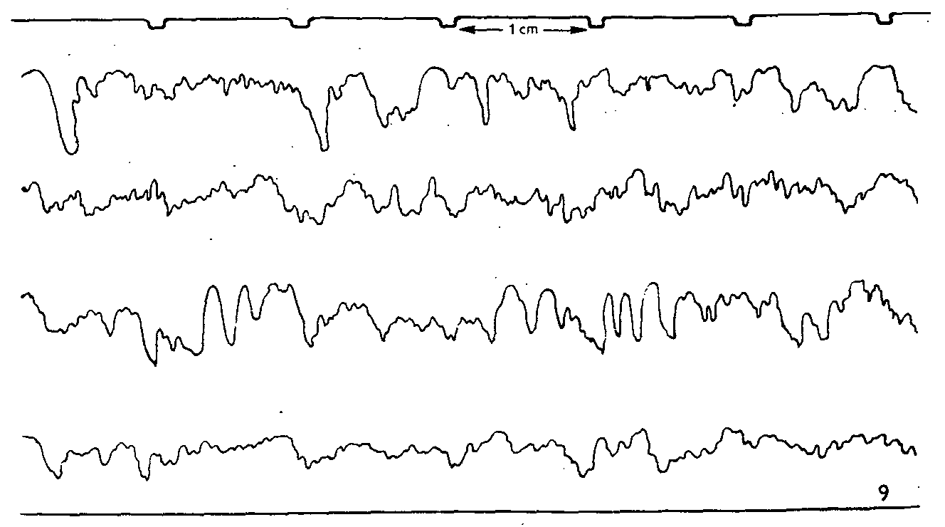 UNODC - Bulletin on Narcotics - 1958 Issue 1 - 003